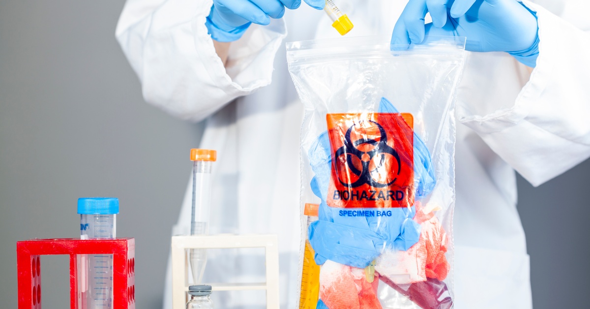 The Science Behind Blood Cleanup Techniques