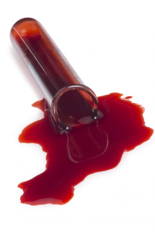 Blood Bodily Fluid Cleanup | Suicides Biohazard | Affinity Bio Solutions AZ